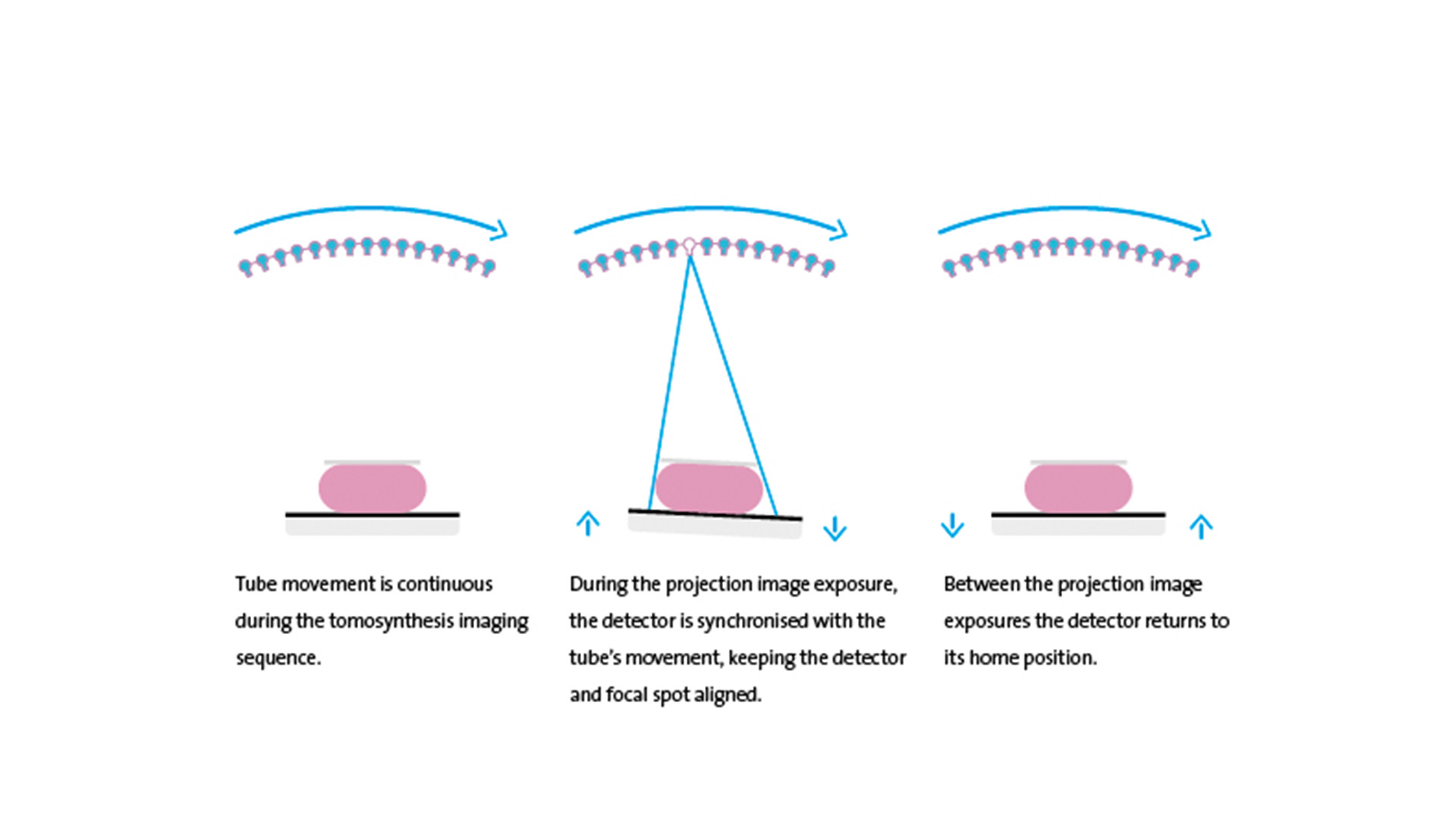 Digital Breast Tomosynthesis Bios Pk